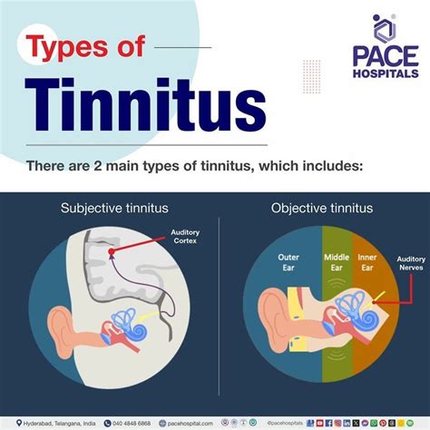 Tinnitus Types Causes Symptoms Treatment Prevention