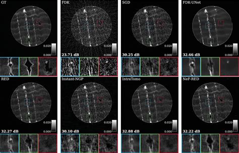 Figure 4 From Neural Field Regularization By Denoising For 3d Sparse View X Ray Computed