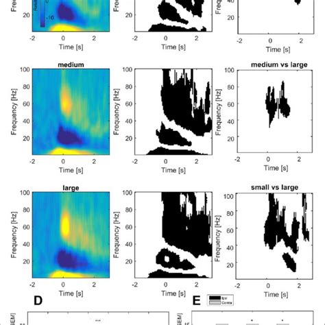 Grand Average Of Subthalamic Oscillatory Activity Aligned To Movement Download Scientific
