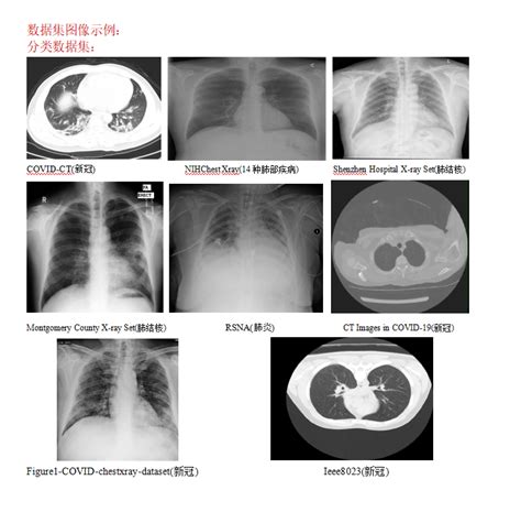 2d 3d图像分割 影像组学 深度学习 python 疾病诊断 教程全集 哔哩哔哩