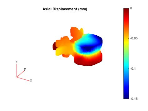 Medical Image Based Finite Element Analysis Of Spine MATLAB Simulink