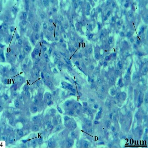 Microphotograph Of Liver Showing The Histological Structure Of The