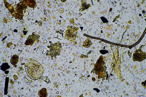 Pseudopenis Aggression And Matriarchy The Sex Life Of Africas Most