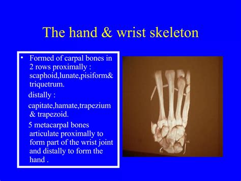 Examination Of The Hand And Wrist Ppt