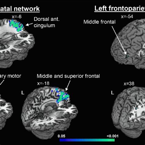 Independent Component Analysis Increased Resting State Functional Download Scientific Diagram