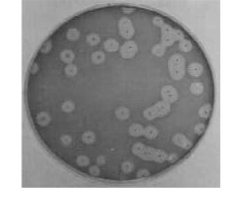 Bacteriocin Producing Lactic Acid Bacterial Colonies Formed The Growth