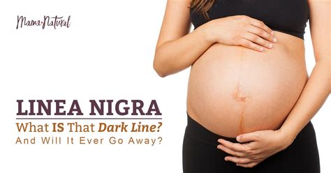 When Does Linea Nigra Fade Linea Nigra Pregnant Ghuz