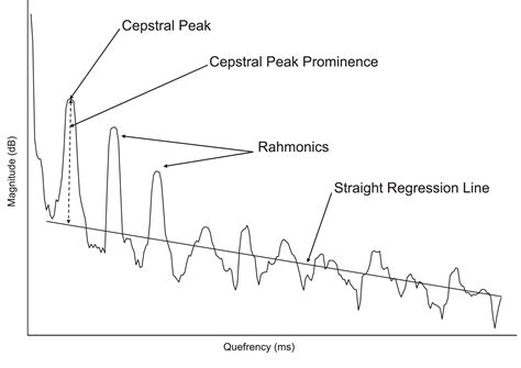Cpps And Voice Source Parameters Objective Analysis Of The Singing Voice Journal Of Voice