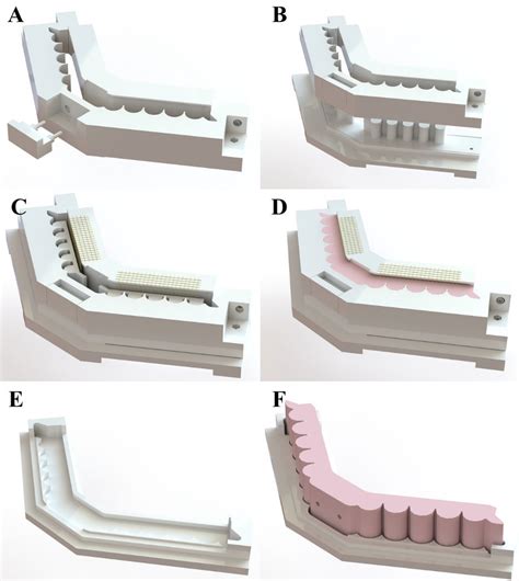 A Flexible Wearable Supernumerary Robotic Limb For Chronic Stroke Patients