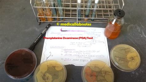 Phenylalanine Deaminase Pda Test Introduction Principle