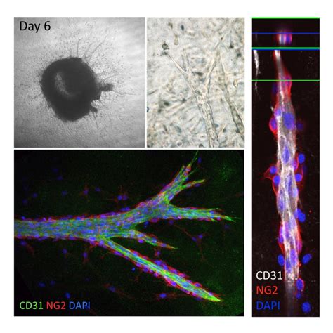 Aortic Ring Assay Kreuger Lab