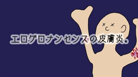 Serious Skin Disease Xxx Mobile Porno Videos And Movies Iporntv Net