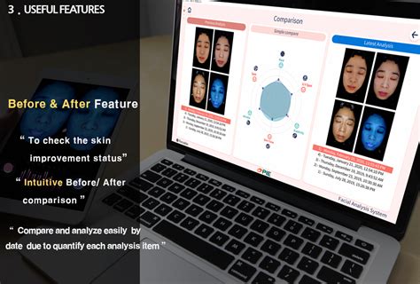 Focuskin Facial Skin Analysis System Tradekorea