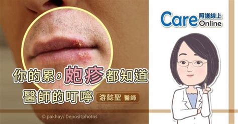 唇皰疹 Sunnyjerry 的部落格 Udn部落格