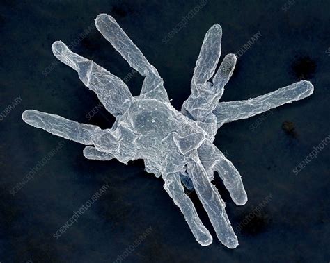 Amoeba Sem Stock Image C0217229 Science Photo Library