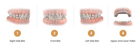 Teeth Whitening Creative Smiles Turkey