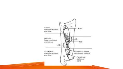 Fracture Shaft Of Radius Ulna 2021 Pptx