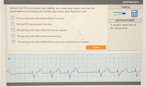 Solved Question 4 ﻿of 15analyze This Vvi Pacemaker Strip