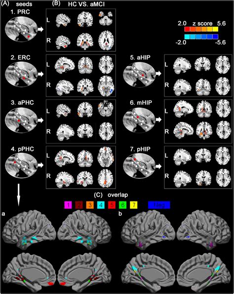Resting State Functional Connectivity Patterns Between Group Maps Of