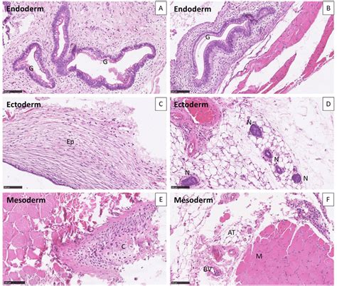 Germ Cell Layer Components Within Teratomas The Differentiation At Download Scientific