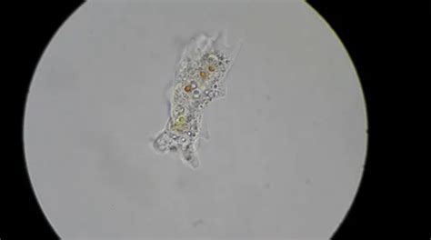 Unicellular Amoeba Motion Under Microsco Stock Video Pond5