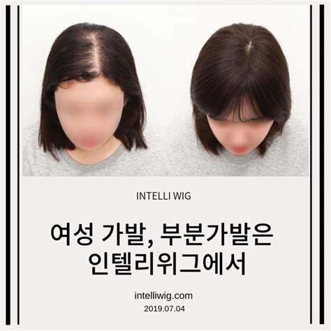 여성 가발 인텔리위그에서 부분가발로 맞췄어요 네이버 블로그