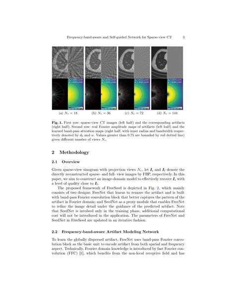 Freeseed Frequency Band Aware And Self Guided Network For Sparse View Ct Reconstruction Deepai