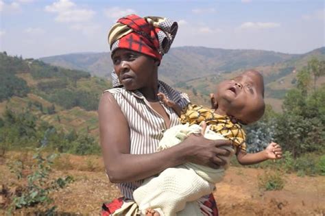 Кога мајка родила вонземјанско бебе ги исплашила и лекарите Мажот ја оставил а луѓето бегале