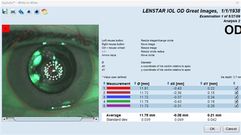 Lenstar 900 Optical Biometry