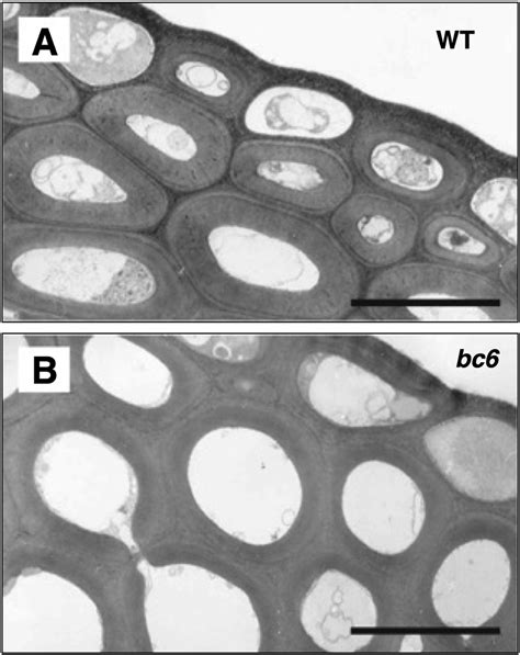 Electron Microscope Image Of Brittle Culm6 Most Of The Brittle Culm