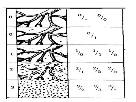 Ilo Classification Of Standard Chest Radiographs Of Pneumoconioses