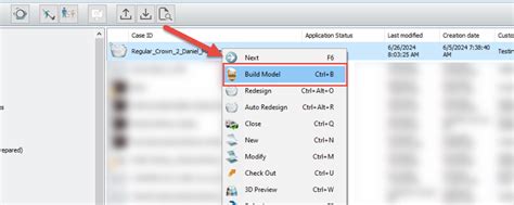 3shape Automate Mixed Orders With Model Builder Elements 3shape Design Services