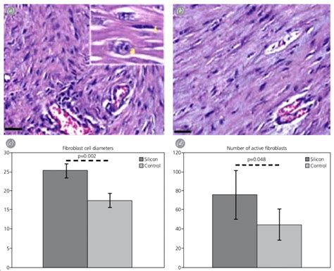 An Increased Infiltration Of Active Fibroblasts Per Area Was Observed Download Scientific