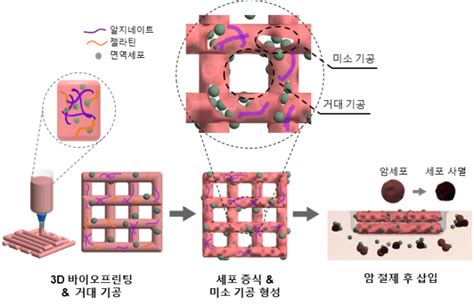 3d 바이오프린팅 기술로 암세포 잡는다 Zdnet Korea