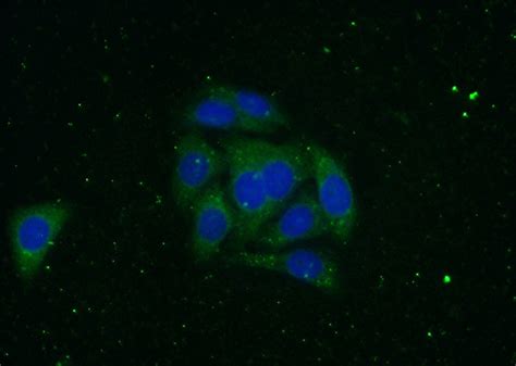 Alpha 2 Macroglobulin Rabbit Polyclonal Antibody
