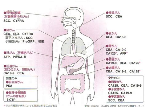 腫瘍マーカー 一覧表全身 腫瘍マーカー ガイドライン Lxcm