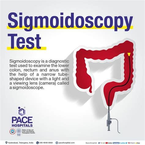 Sigmoidoscopy