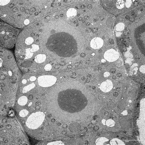 Core Facility For Electron Microscopy Universität Tübingen