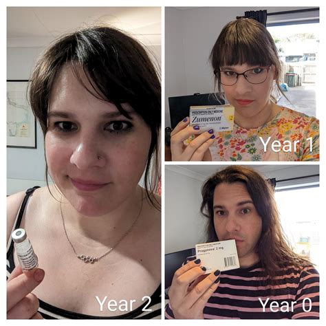 I Cant Believe Its Already Been 2 Years Since I Started Hrt 😊 Why