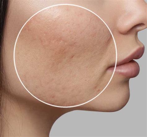 Facial Concerns Aesthetics Clinic Nottingham Skin Clinic West Bridgford