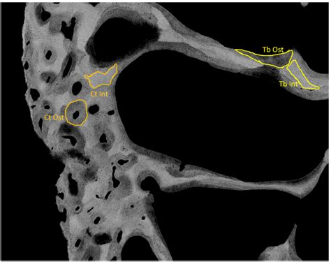 Example Of Bone Structural Units Bsus Selected For The Degree Of Download Scientific Diagram