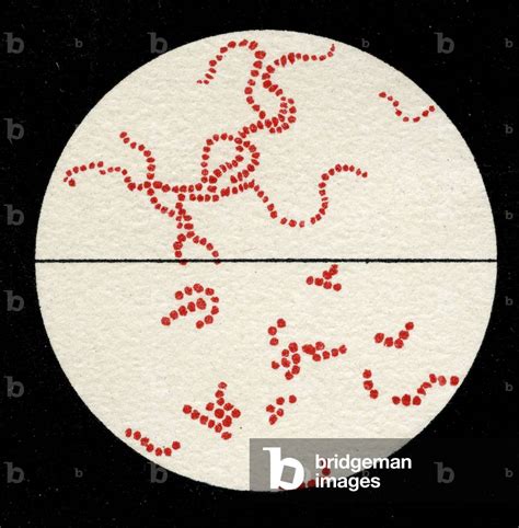 Image Of Colony Of Streptococcus Pyogenes 1906 Litho By German