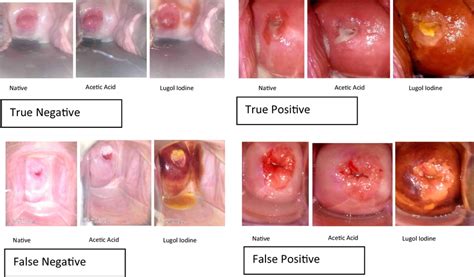 Visual Images Of Various Categories Of Screening Outcomes Download Scientific Diagram