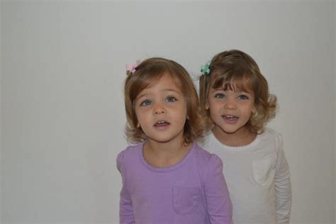 The Incredible Story Of The Clement Twins And What Theyre Up To Now Dailyforest