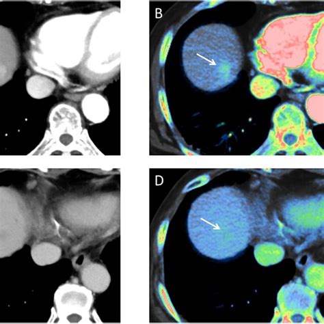 Diagram Of Three Material Decomposition Download Scientific Diagram