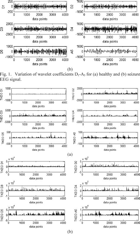 Figure 1 From Detection Of Epilepsy Based On Discrete Wavelet Transform And Teager Kaiser Energy