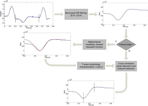 Figure 1 From New Approach For T Wave Peak Detection And T Wave End Location In 12 Lead Paced