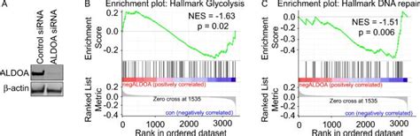 Thais Sobanski On Linkedin The Fructose Bisphosphate Aldolase A Aldoa Facilitates Dna Pkcs And…
