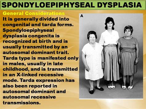 Spondyloepiphyseal Dysplasia Radiology Classroom Facebook