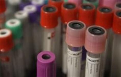 Frozen Tissue Embedding Protocol Creative Bioarray Creative Bioarray